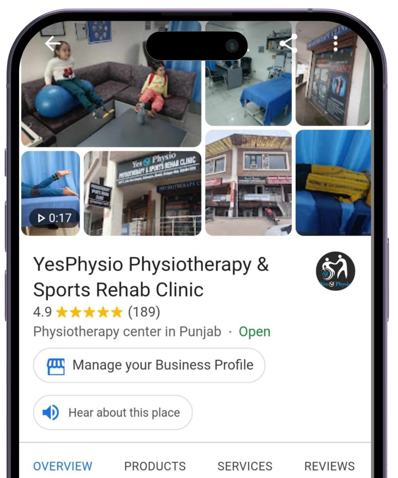 What is Hot Fomentation (Heating Therapy)? - Yes Physio